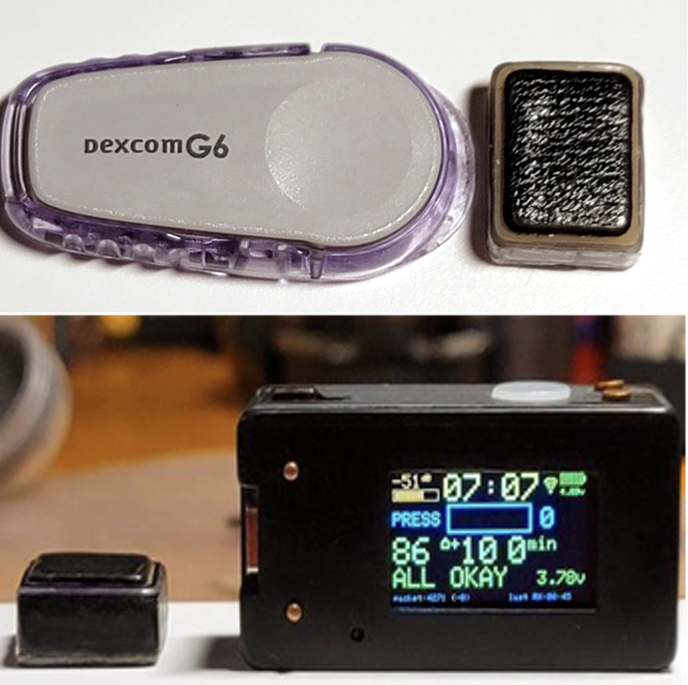 Sensing compression artifacts in blood glucose monitors | TechLink