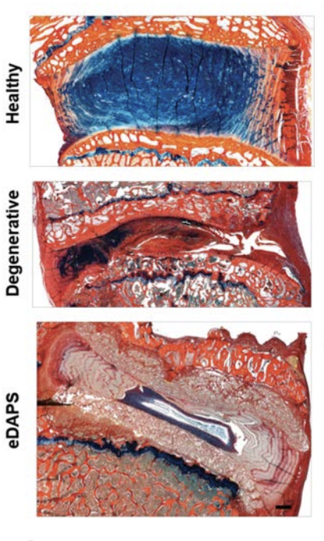 Intervertebral Disc Histology
